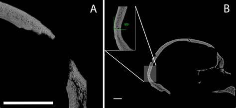 Ct Cross Sections Comparing Perimortem And Postmortem Fractures In The