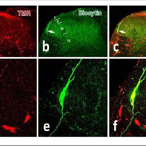 Identification Of The Patch Clamp Recorded Projection Neurons By