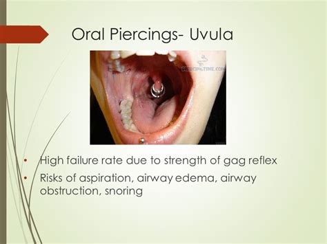 Uvula Piercing