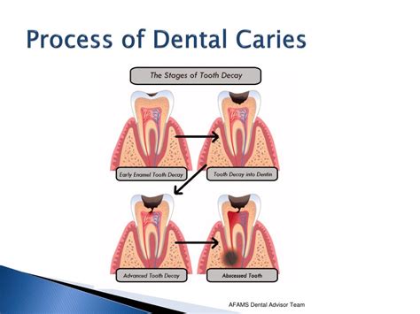 Ppt Cariology Powerpoint Presentation Free Download Id1897264