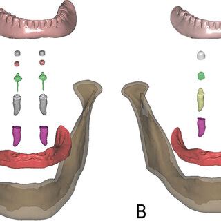 Meshing And Fixation Of The Finite Element Analysis FEA Model The Download Scientific