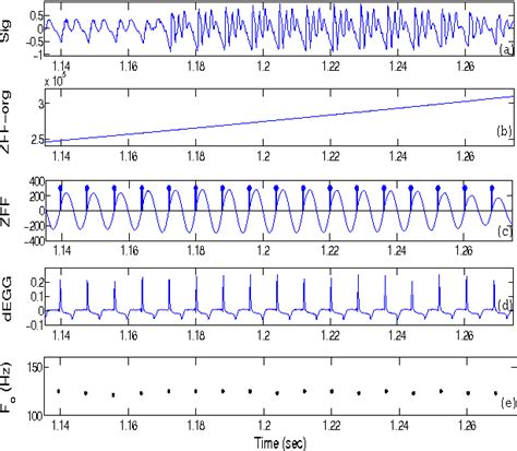 Figure 1 From A Robust And Alternative Approach To Zero Frequency