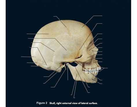 Sphenoid Bone Superior Posterior And Anterior — Printable Worksheet