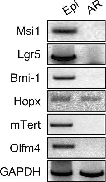 Expression Of Stem Or Progenitor Cell Marker Mrna In Anoikis Resistant Download Scientific