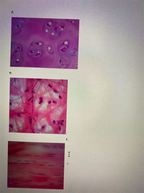 Connective Tissue Lab Activity Identify Each Of Chegg