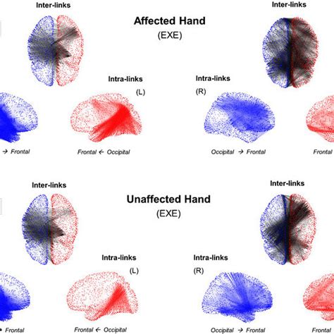 Brain Networks Constructed From Scalp Eeg Signals During Movement