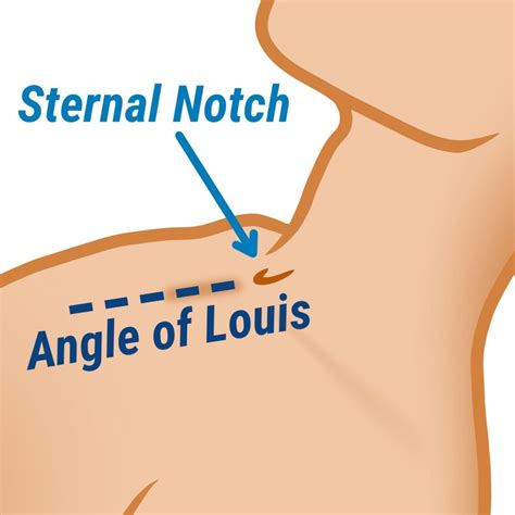 Jugular Vein Pulsation Delaware Vein Center