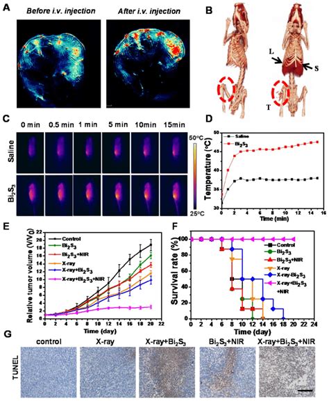 Dual Modal Imaging And Enhanced Radiation Therapy Combined With