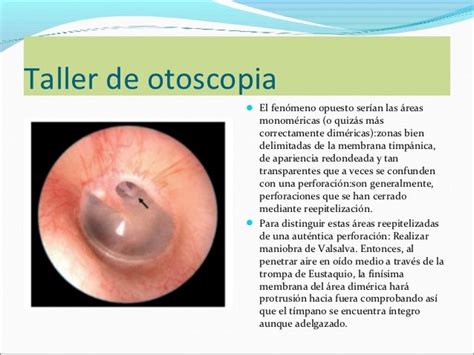 Taller De Otoscopia
