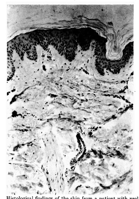 Figure 1 From Prolinuria Transport Of Proline By Leukocytes Semantic Scholar