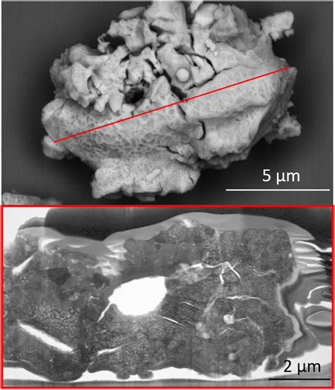 Scanning Electron Microscopy Picture Of A Recovered Grain Top With Download Scientific