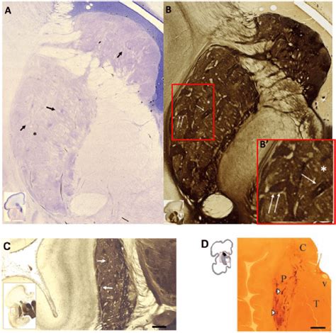 Modular Organization Of Striatum And Structural Plasticity After