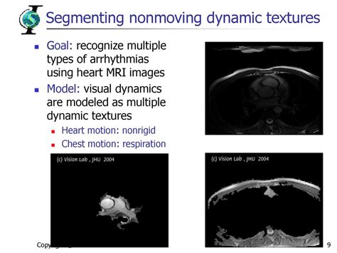 Optical Flow Estimation And Segmentation Of Moving Dynamic Textures