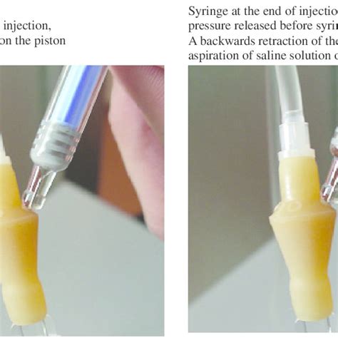 Experiments 1 And 2 In Vitro Simulation Of The Intravenous I V Download Scientific Diagram