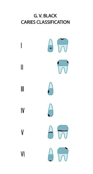 Cavity Form Classification Over 4 Royalty Free Licensable Stock