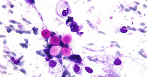 Cat Health News From The Winn Feline Foundation Cryptococcus