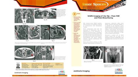 Mars Mri Magnetic Resonance Spectroscopy In Mumbai India Picture This