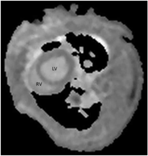 t1 measurements in a rat model of acute myocardial ischemia reperfusion