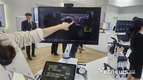 삼성메디슨 연매출 6000억 정조준조직개편·신시장 진출 속도