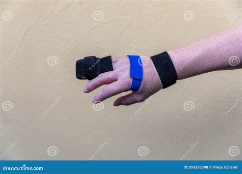 Two Sided Finger Splint With Two Hook And Loop Straps On A Broken Finger Stock Photo Image Of