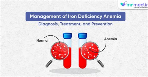 Management Of Iron Deficiency Anemia Diagnosis Treatment And Prevention