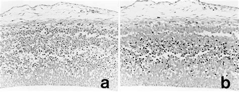 Telencephalic Wall Of A Fetus Of The Hu Treated Group At 12 Hat Almost
