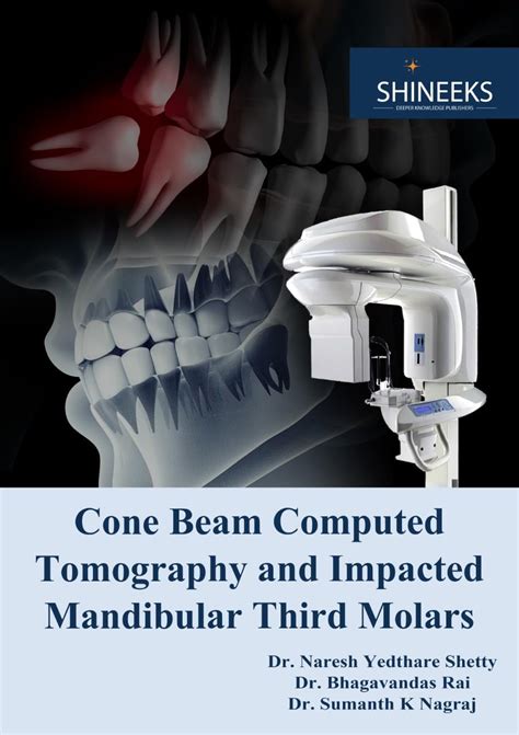 Cone Beam Computed Tomography And Impacted Mandibular Third Molars Ebook Shetty Dr Naresh