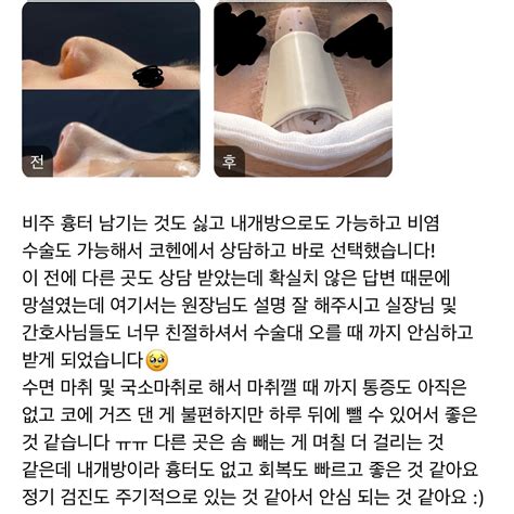 내개방코성형내개방코재수술비개방코성형자가늑코수술 코헨성형외과💕 양쪽 코안으로 절개하여 수술하는 내개방코성형 비주를 개방
