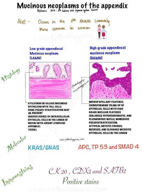 Mucinous Neoplasms Of The Appendix Pathology Mcqs