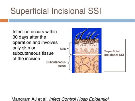 Dr Nuha Alsaleh Mdmscfrcsc Ppt Download