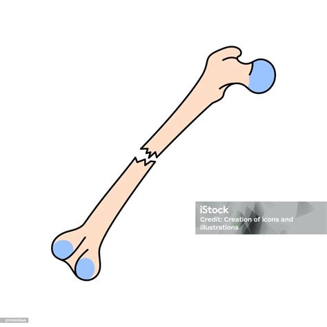 Closed Bone Fracture Line Icon Stock Illustration Download Image Now Anatomy Biology Bone