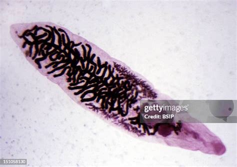 Egyptian Intestinal Fluke Photos And Premium High Res Pictures Getty
