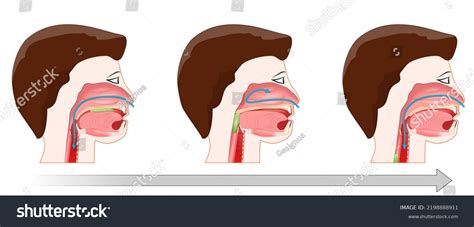 Swallowing Process Deglutition After Form Bolus Stock Vector Royalty