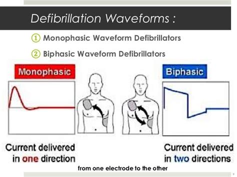 Smart Biphasic Waveform Defib Explained Jmng