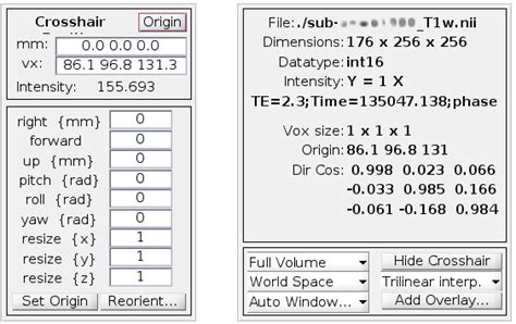 Looking At The Data — Mri Analyses Handbook 02 Documentation