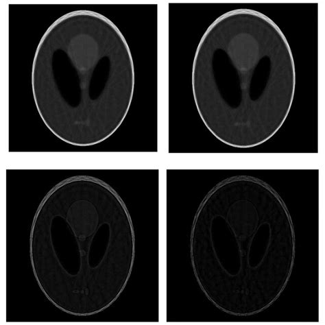 The Number Of Projection Angles Is 30 The First Row Is The Result Of Download Scientific