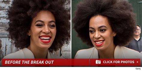 Solange Im Under Attack By My Face Photo