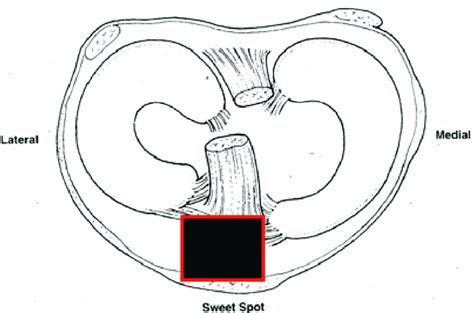 Axial Cross Section Of Knee With Soft Tissue Attachments Download