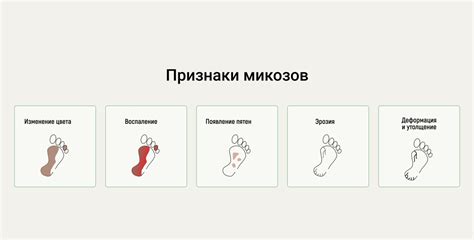 Грибок стопы: причины, симптомы и лечение
