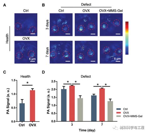 多管齐下！一种有望修复骨质疏松性骨缺损的复合水凝胶 知乎