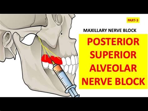 Superior Alveolar Nerve Block Landmarks
