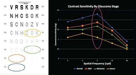 The Contrast Sensitivity Story Glaucoma Today