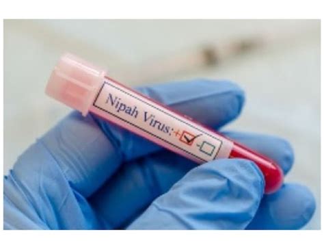 Nipah Virus निपाह वायरस कितना खतरनाक क्या हैं इसके लक्षण इलाज और बचाव जानें सबकुछ Kerala
