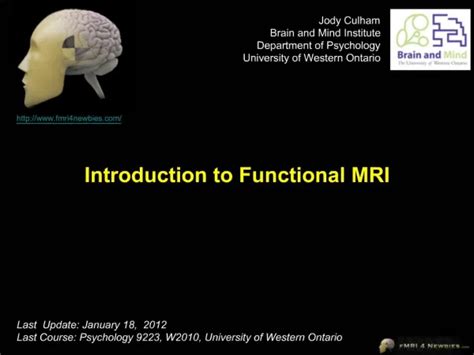 Ppt Functional Mri System Fmri Monitor Powerpoint Presentation Free Download Id 11744946