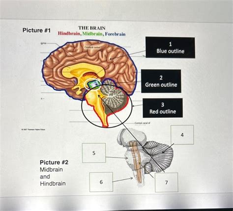 Picture 1 The Brain Hindbrain Midbrain