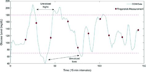 Cgm Plot Illustrating Benefits Of Cgm Over Periodic Fingerstick Glucose