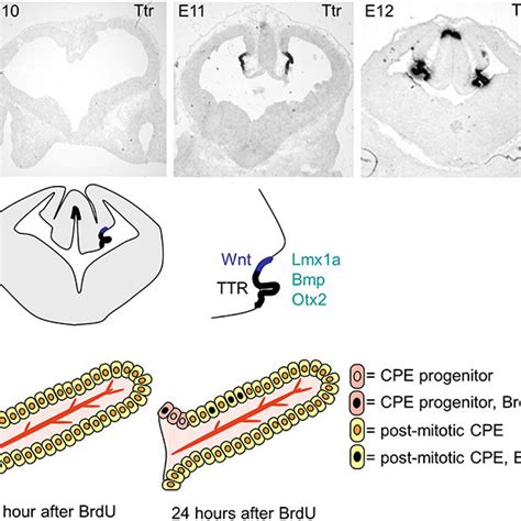 Simplified Schematic Drawing Of How Choroid Plexus Mediated Changes In Download Scientific