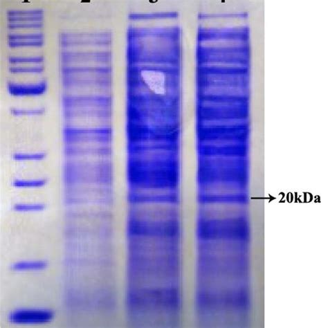 Comparison Of Codon Usage For E Coli In Wild And Optimized HEs Gene Download Table