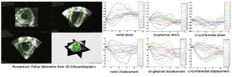 3d Echocardiography Myocardium Motion Estimation Myocardium Motion Is Download Scientific