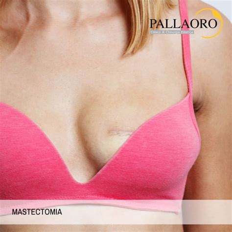 Mastectomia E Ricostruzione Seno Guida Completa Alla Chirurgia